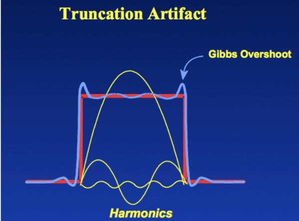 What Is Dithering? How To Achieve Superior Sound Quality